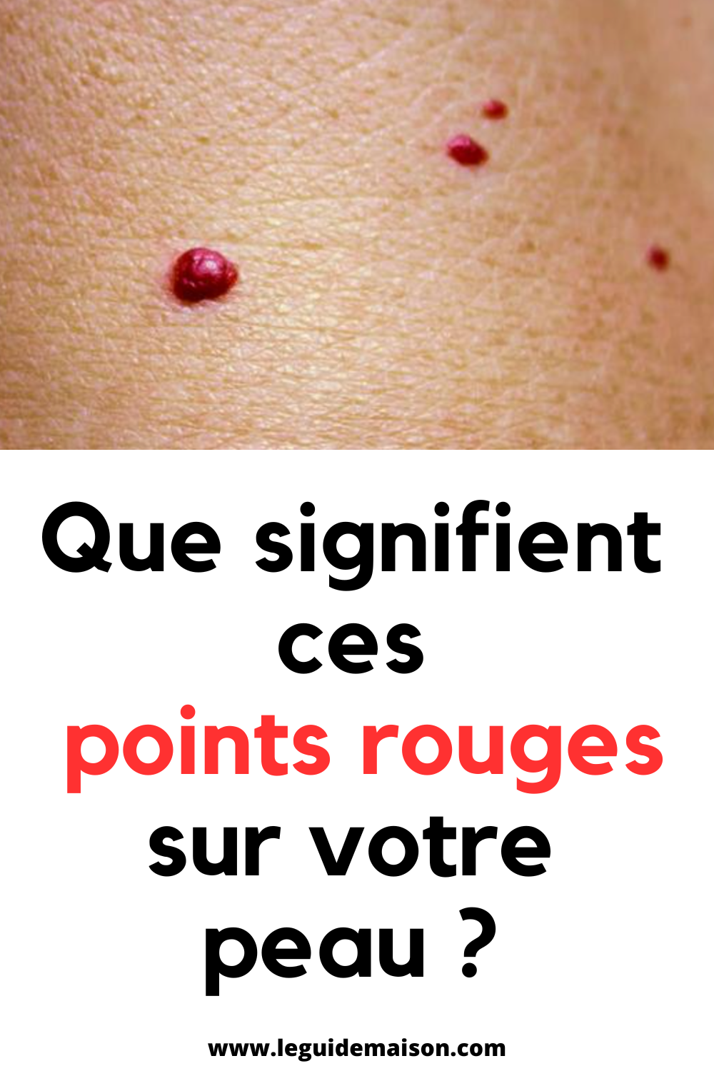 santé Que signifient ces points rouges sur votre pe...