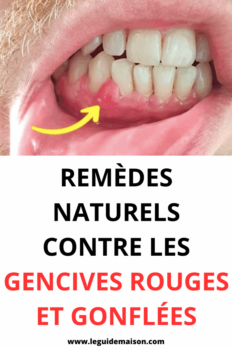 REMÈDES NATURELS CONTRE LES GENCIVES ROUGES ET GONFLÉES - Le Guide Maison
